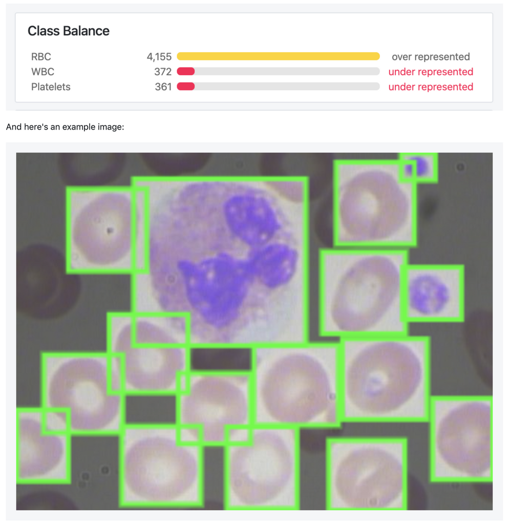 How to Train Detectron2 on Custom Object Detection Data