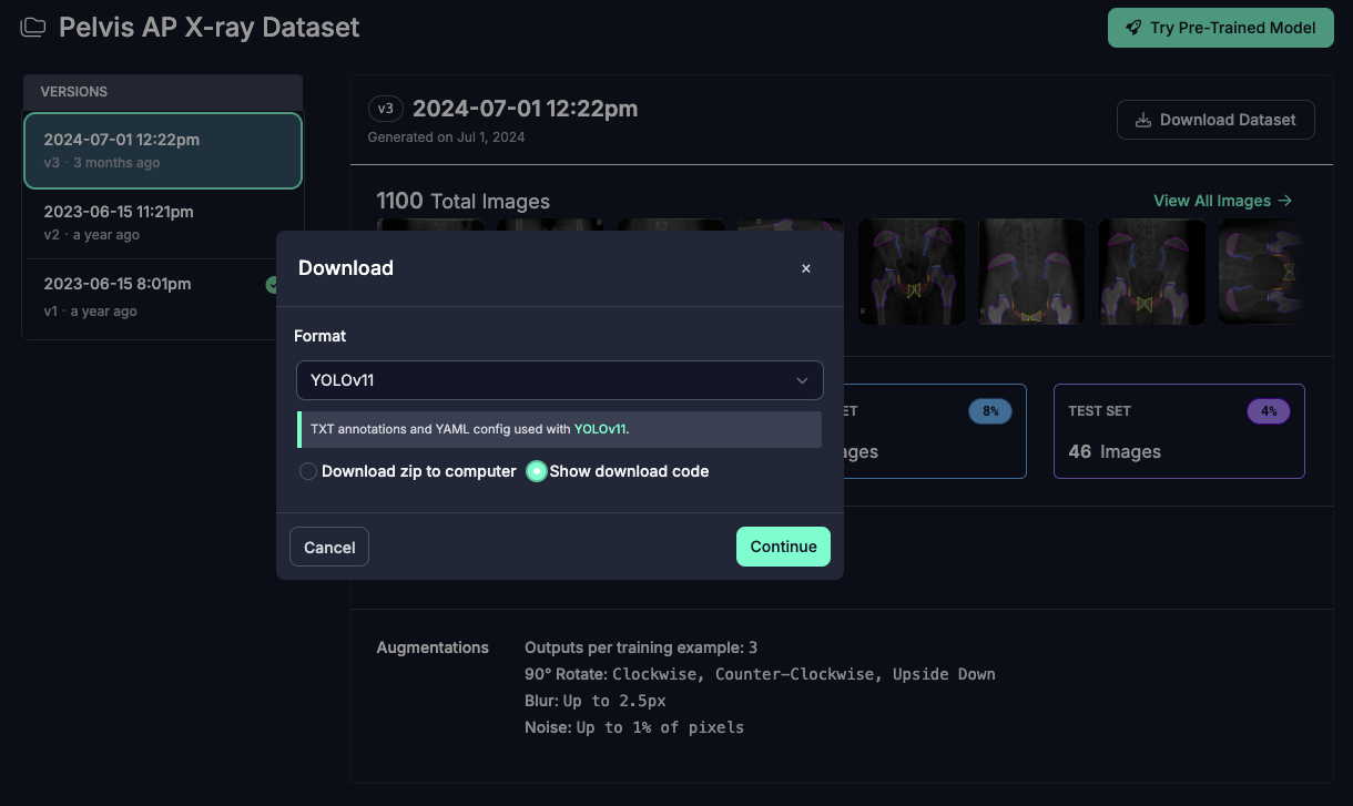 How to Train YOLOv11 Instance Segmentation on a Custom Dataset How to Train YOLOv11 Instance Segmentation on a Custom Dataset
