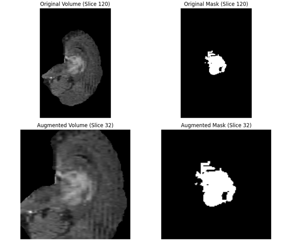 How to Use Albumentations for Computer Vision: Step By Step