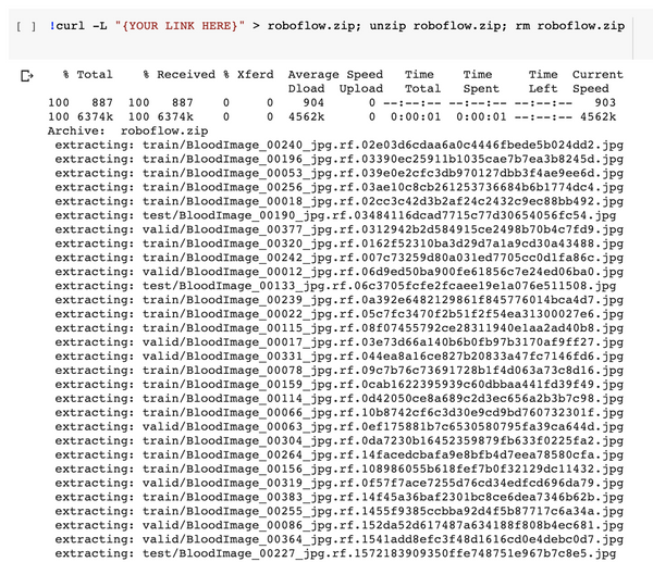 How to Train Detectron2 on Custom Object Detection Data