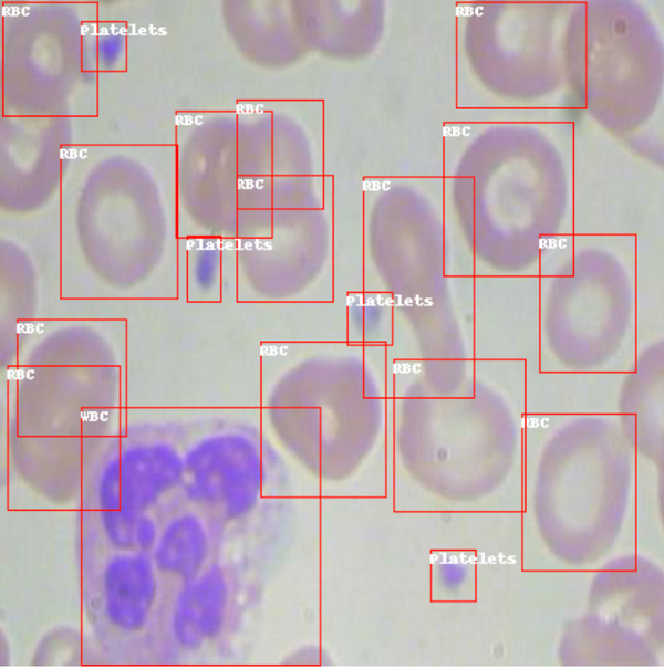 Train and Deploy YOLOS Transformer On a Custom Dataset