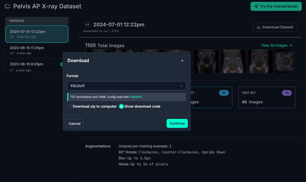 How To Train Yolov11 Instance Segmentation On A Custom Dataset 4809