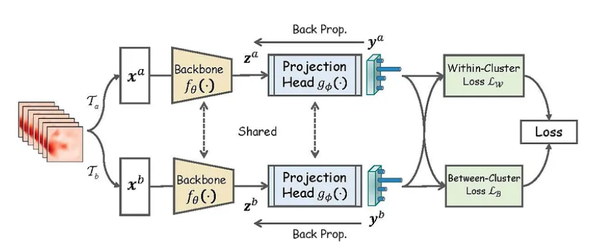What is Contrastive Learning? A guide.