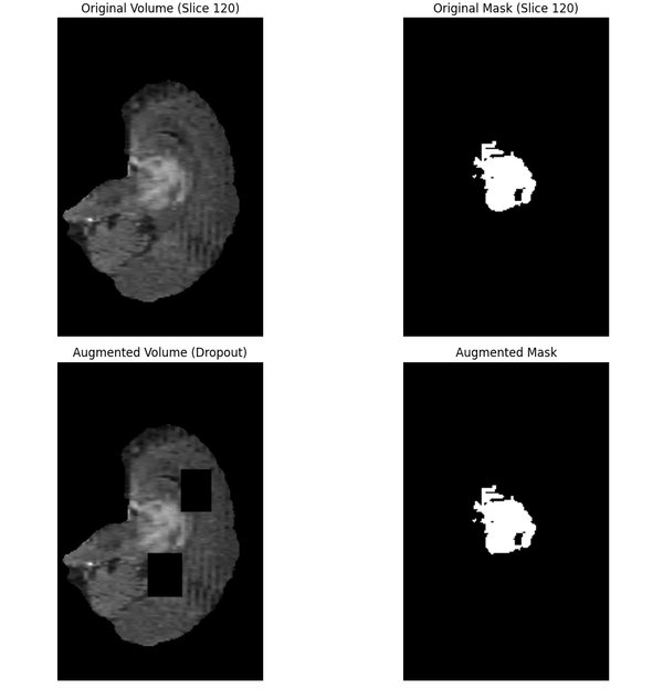 How to Use Albumentations for Computer Vision: Step By Step