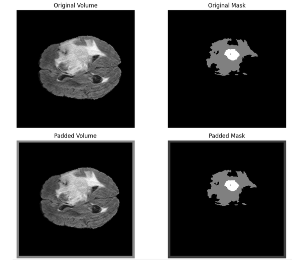 How to Use Albumentations for Computer Vision: Step By Step